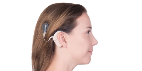 What Happens When a Cochlear Implant Fails?